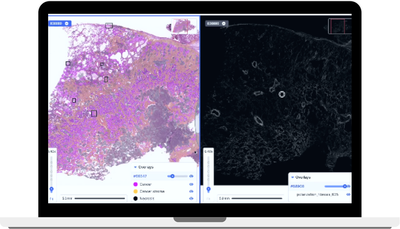 Introducing PathExplore™ Fibrosis